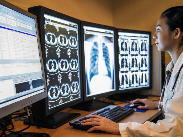 Lung Cancer Awareness Month: How screenings can save lives - 607 News Now